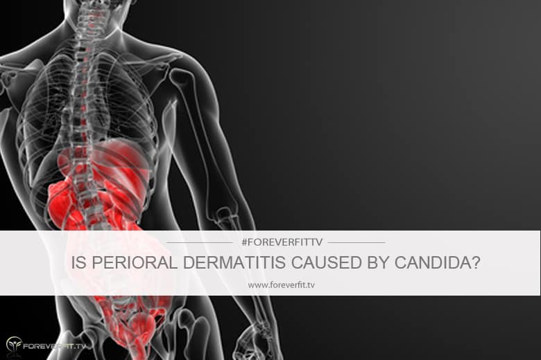 Is-perioral-dermatitis-caused-by-candida-1 - Foreverfit